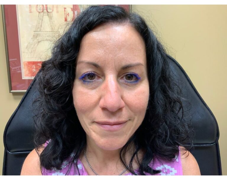 Cosmetic Procedures | Dr. Barry Edison