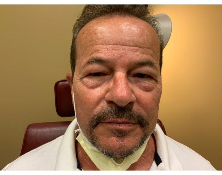 Cosmetic Procedures | Dr. Barry Edison